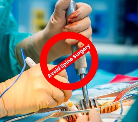How to avoid spine surgery - Synapse Spine
